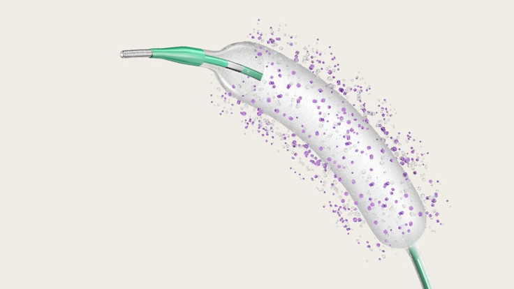 SeQuent® DCBs – Coronary Drug Coated Balloons - B. Braun