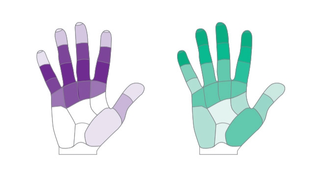 AESCULAP Aicon® sterile container system - B. Braun