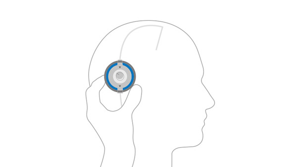 MIETHKE M.blue® – Adjustable gravitational valve for the treatment of ...