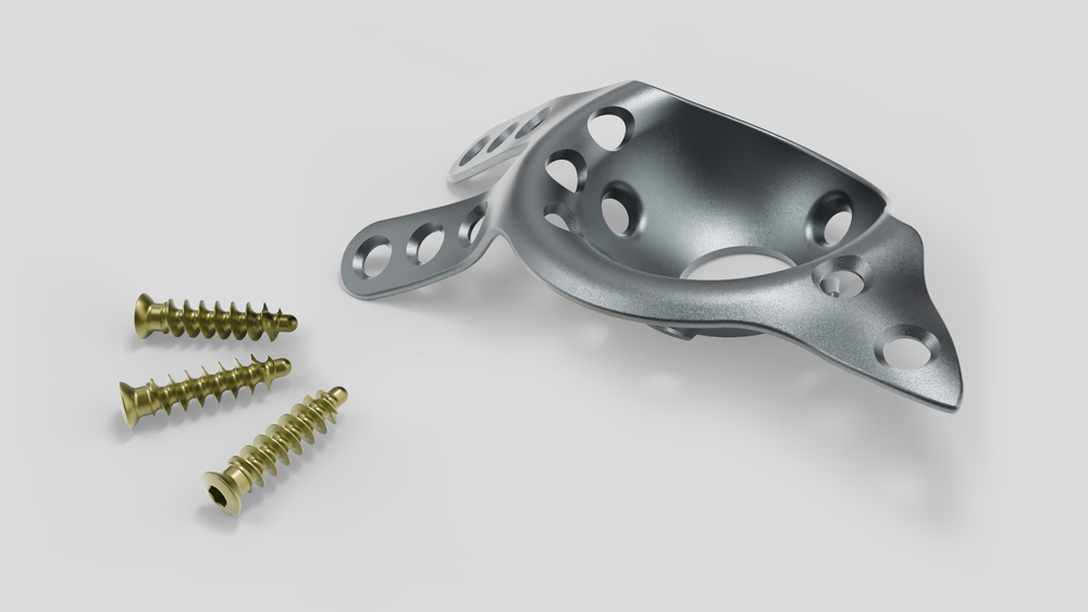 AESCULAP® Hip Revision Solutions - B. Braun