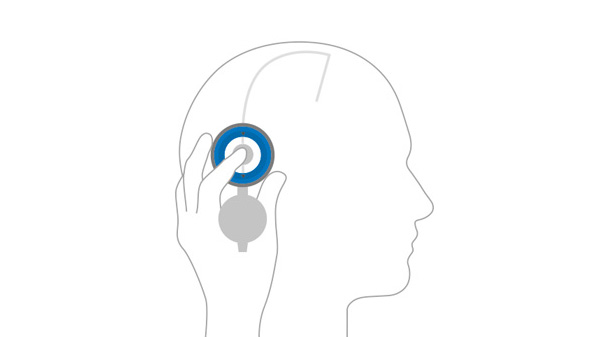 MIETHKE M.blue® – Adjustable gravitational valve for the treatment of ...