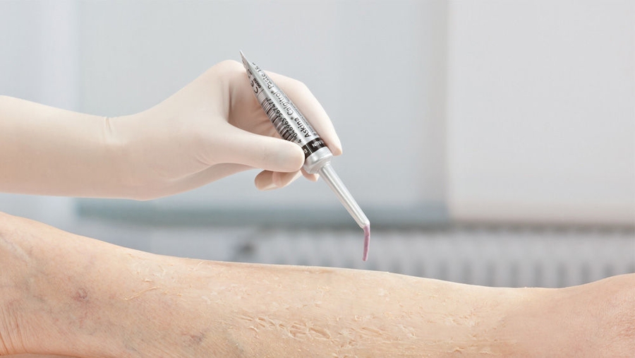 Askina Calgitrol - B. Braun